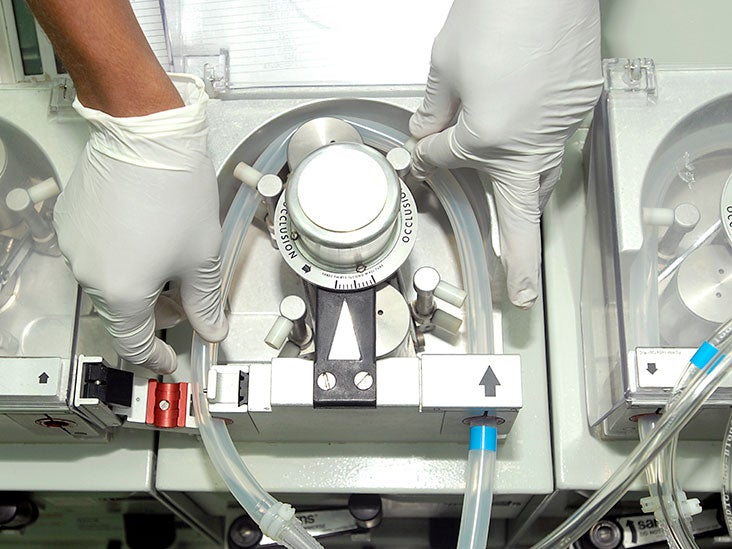 What is a perfusionist? Responsibilities and expertise