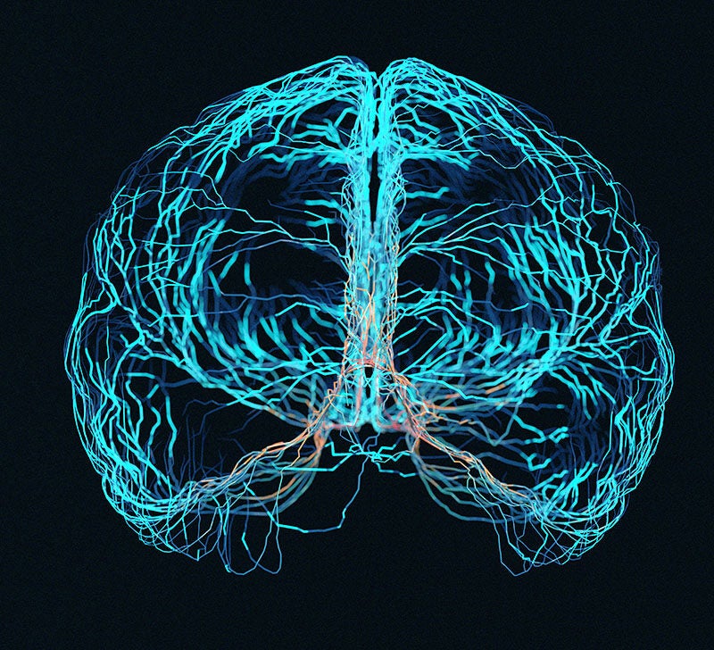 Subconcussive head impacts: What to know