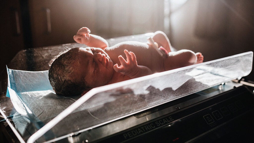 Urachal cyst: Symptoms, causes, and treatment