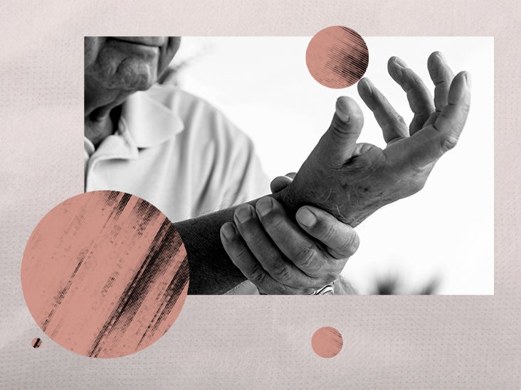 Eczema lesions: Treatment and more