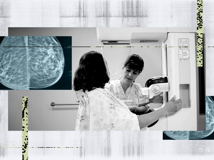 Breast Cancer Mammogram Machine