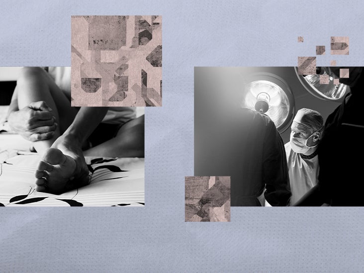 Plantar fasciitis surgery: Goal, procedure, and recovery