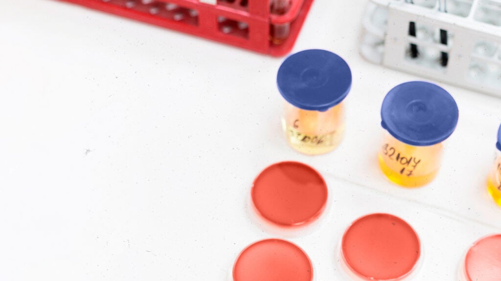 Early cancer detection: Noninvasive test spots 14 cancer types