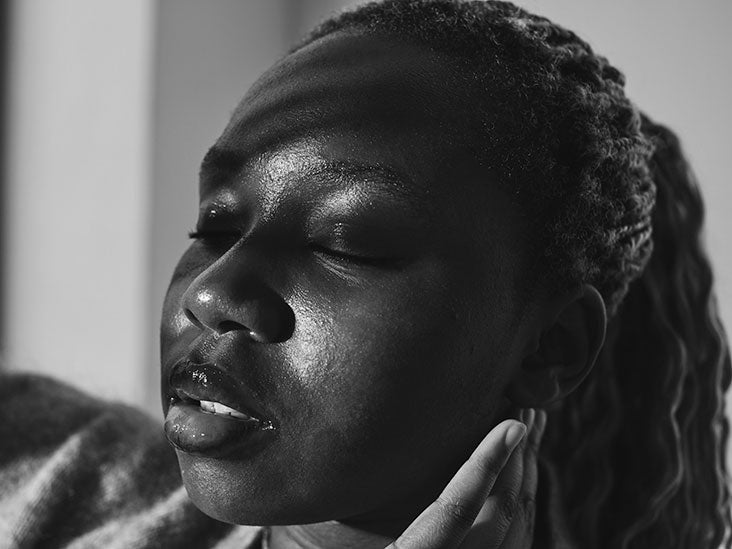 What are treatment options for relapsing polychondritis?