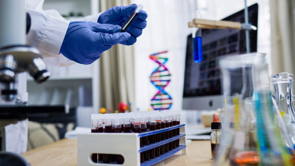 HIV and Kaposi sarcoma: The connection, prevalence, and risk factors