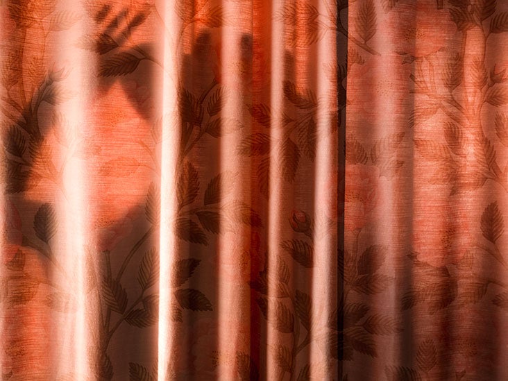 Why does sun exposure trigger a lupus rash?