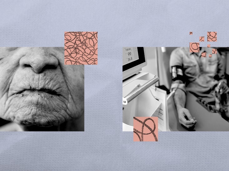 Immunotherapy for oral cancer