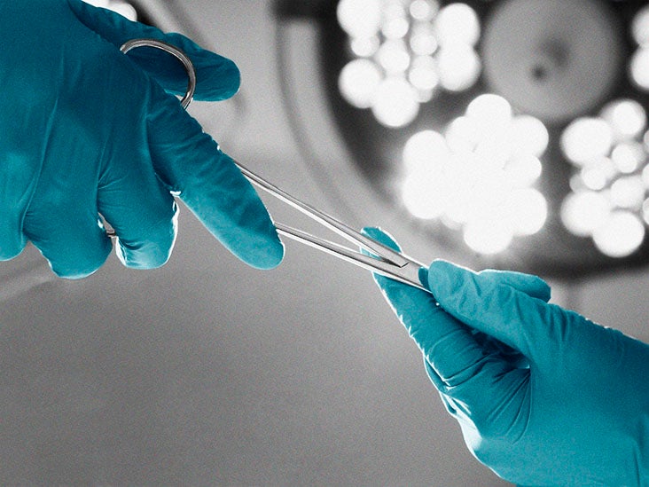 VNS for epilepsy: What to expect