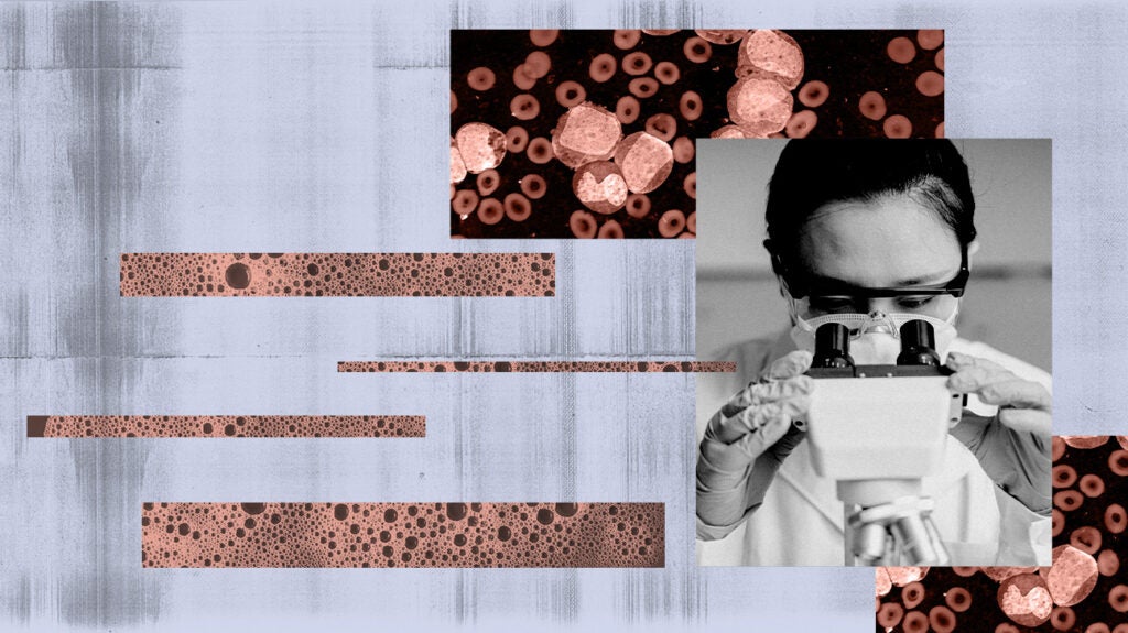 What tests can diagnose and stage AML?