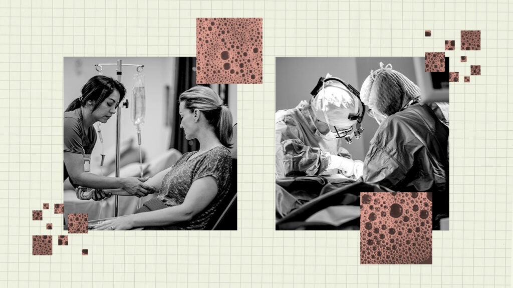 Bladder cancer treatment: Options and more