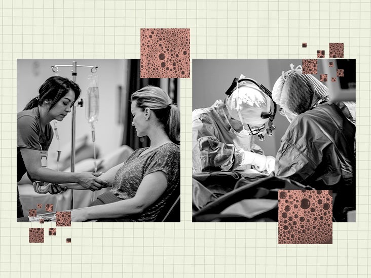 Bladder cancer treatment: Options and more