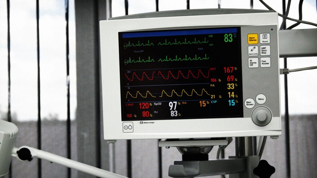 Heart failure diagnosis: Tests and classification