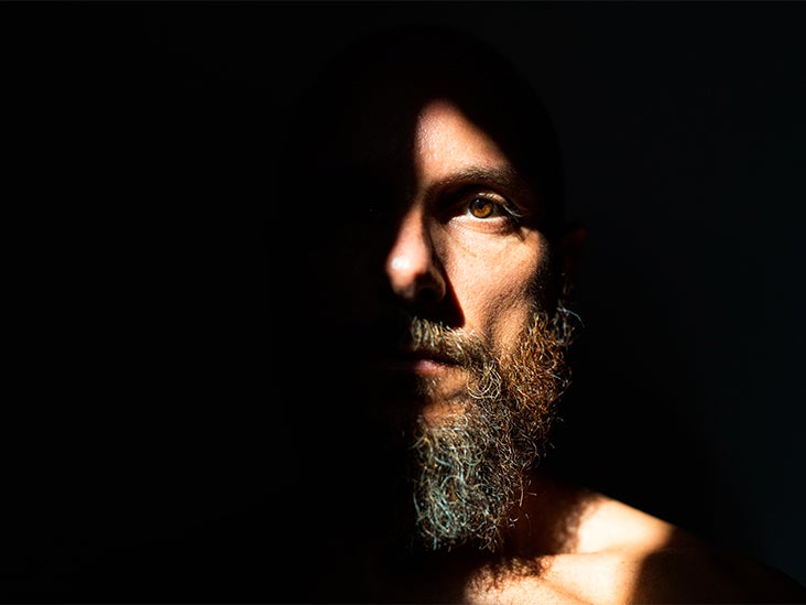 Bell's palsy recovery: Signs, stages, and tips