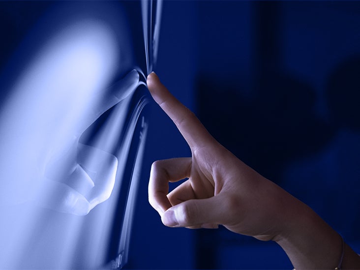 Can responsive neurostimulation help treat epilepsy?