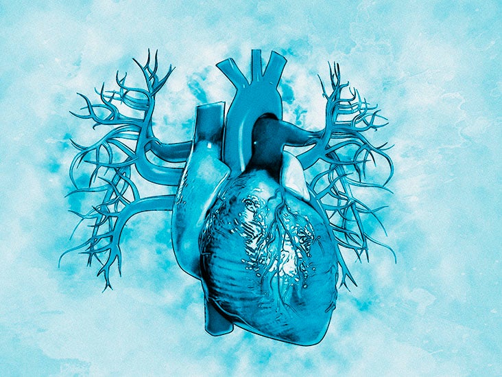 Biggest heart attack: Types and causes