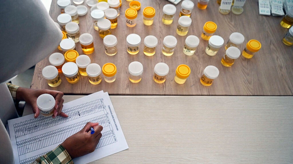 Interstitial cystitis vs. normal bladder: Differences and urination fr