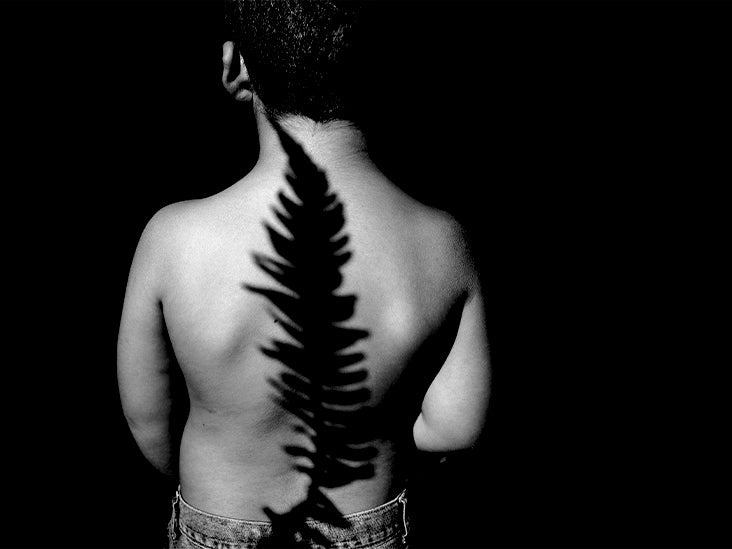 Bone cancer in children: what to know