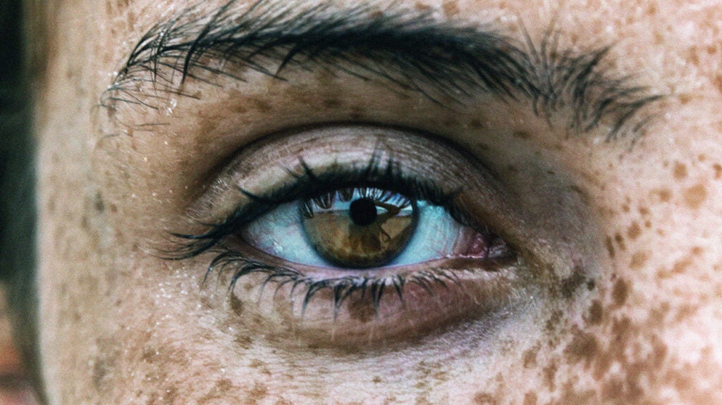 What are some signs of macular degeneration?