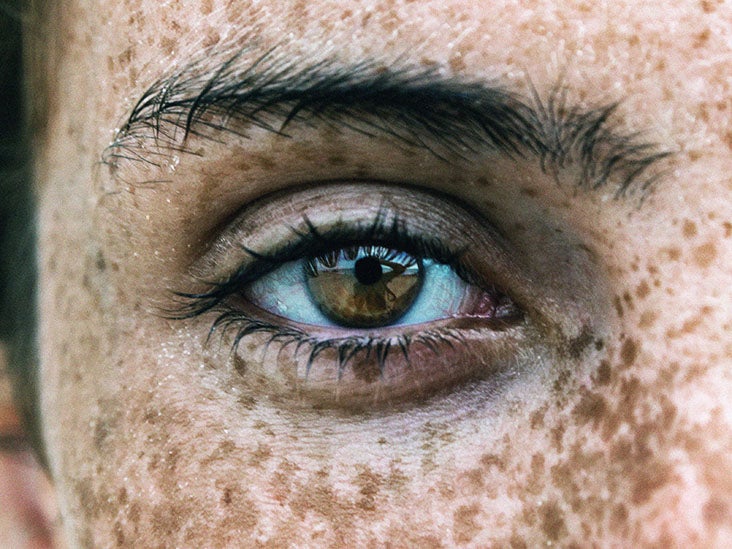 What are some signs of macular degeneration?