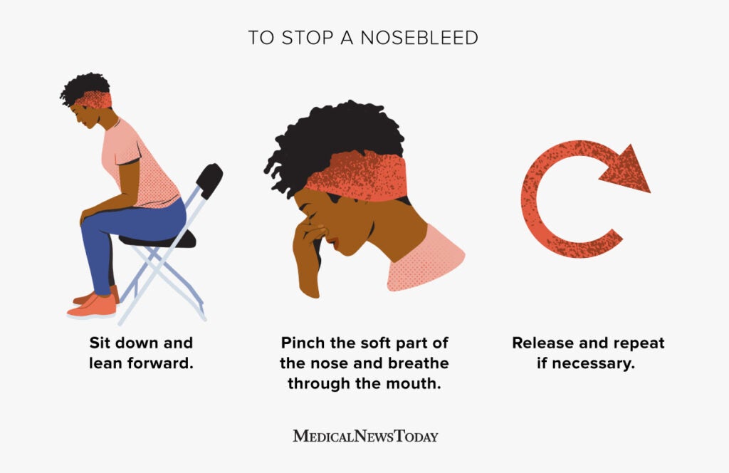 How To Stop A Nosebleed Tips And Treatment