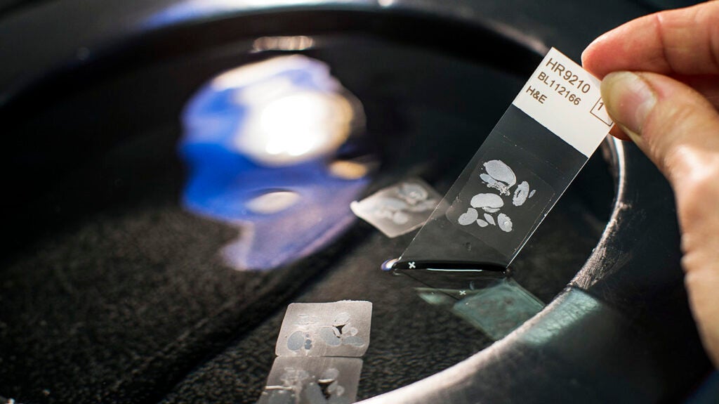 Cancer cells: How they shrink or grow larger to survive