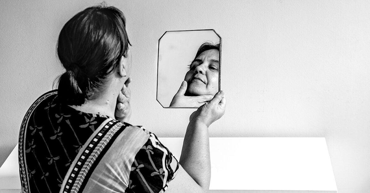 Hereditary angioedema (HAE) and allergy: How to differentiate