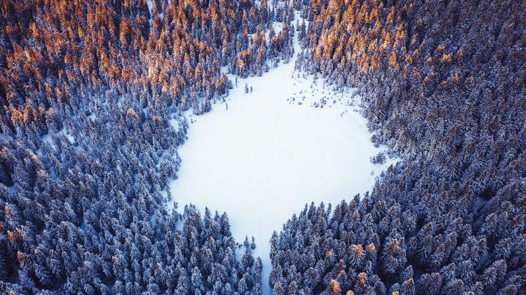 Annular psoriasis: Definition, symptoms, causes, and more