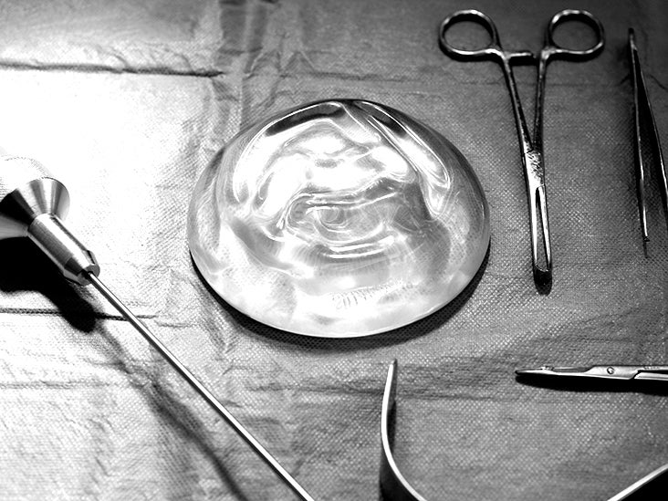 Breast implants and cancer risk: Link, signs, and what to do