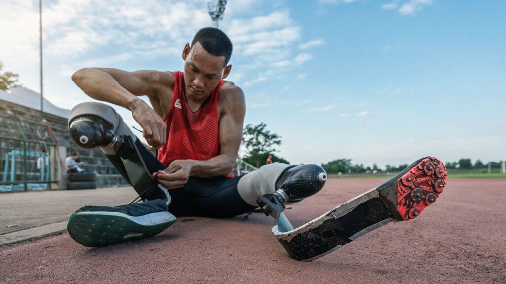 What is phantom pain? Examples, cause, and treatment