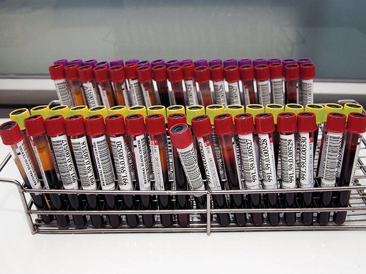 How blood tests help diagnose different types of pituitary tumors