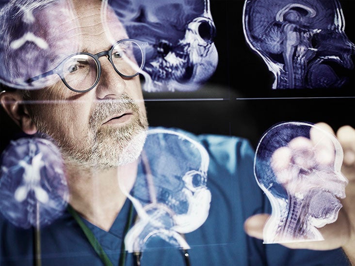 Posterior circulation stroke: Symptoms, treatment, and outlook