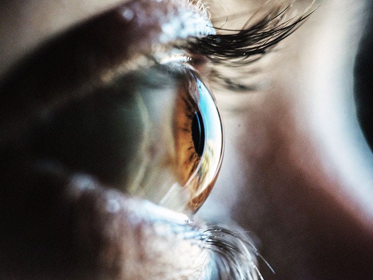 Can diabetes lead to vision loss?