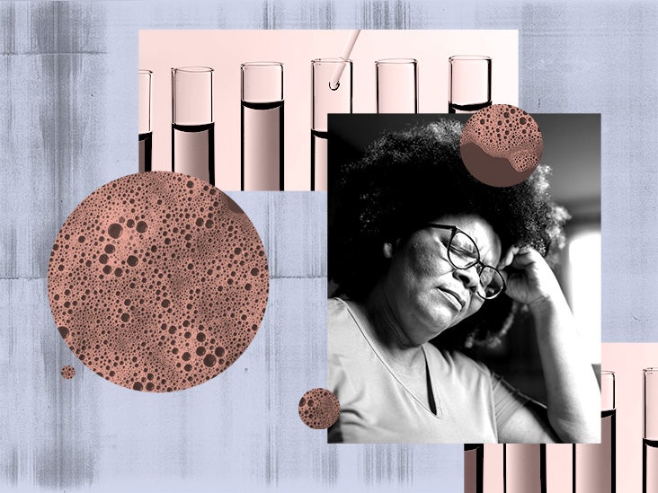 Hyperammonemia: Definition, symptoms, causes, treatments