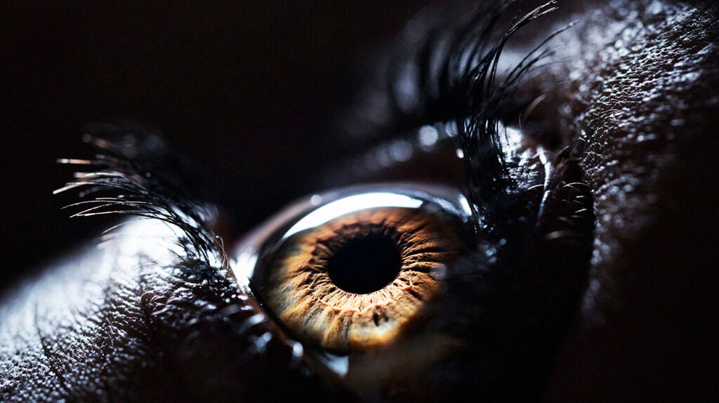 Ocular surface staining: Procedure, scores, and results