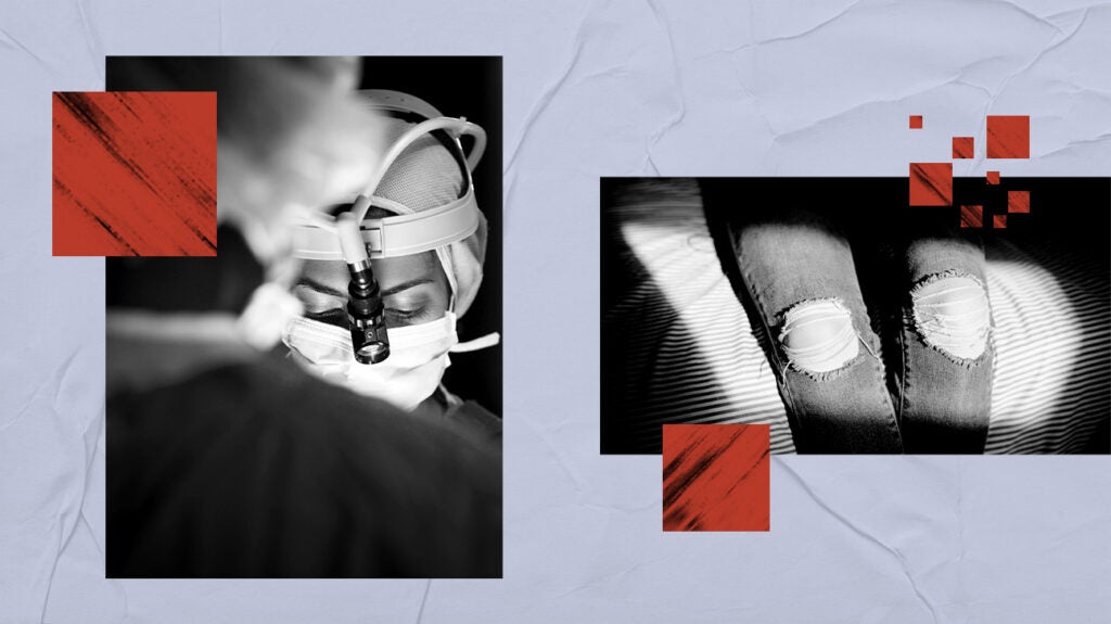 ACL reconstruction surgery: Procedure, preparation, recovery, and more