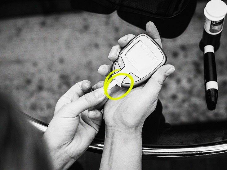 What is acute hyperglycemia? Symptoms and treatment