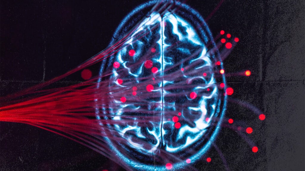 Schizophrenia: How blood vessel growth in the brain may be a factor