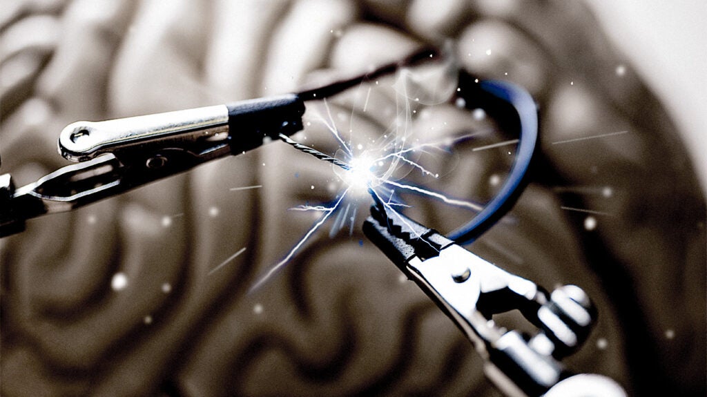Alzheimer's: More evidence for 'amyloid hypothesis'