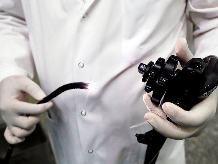 Type 2 diabetes: Endoscopic procedure may reduce the need for insulin