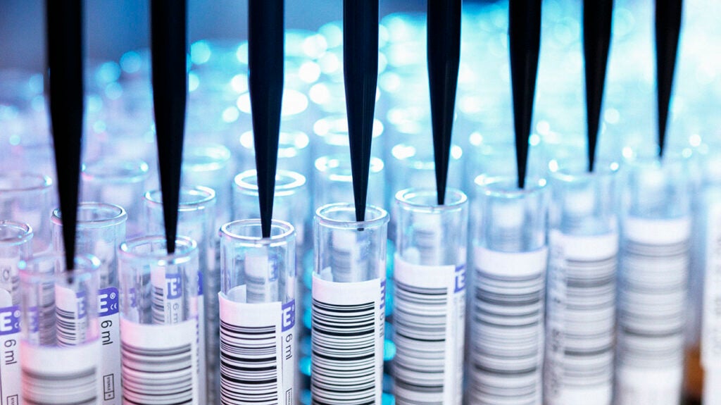 ALL leukemia diagnosis, tests, symptoms, and more