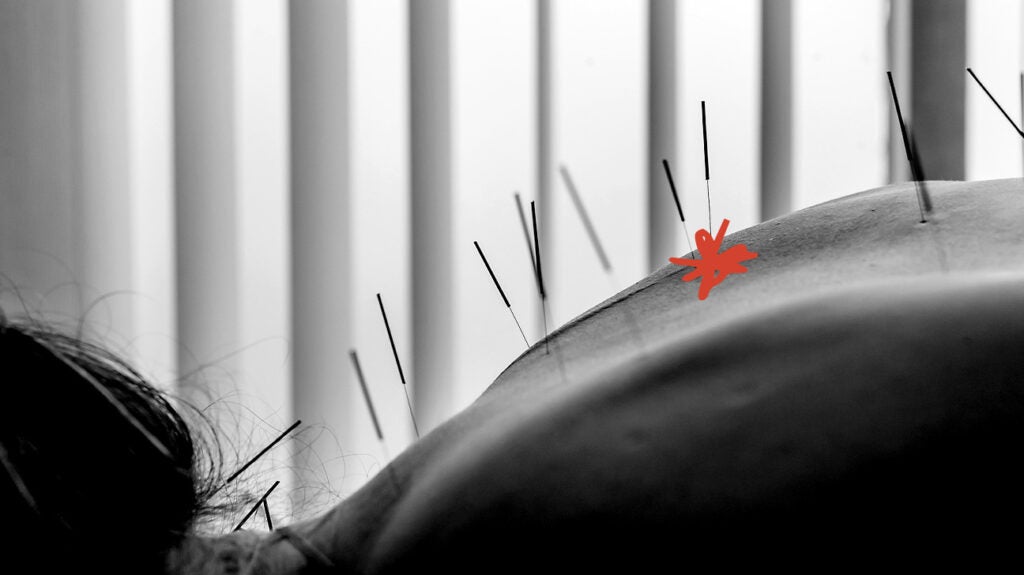 Acupuncture for asthma relief: Can it help?