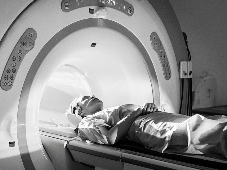 Aggressive multiple sclerosis: Diagnosis, treatment, and outlook