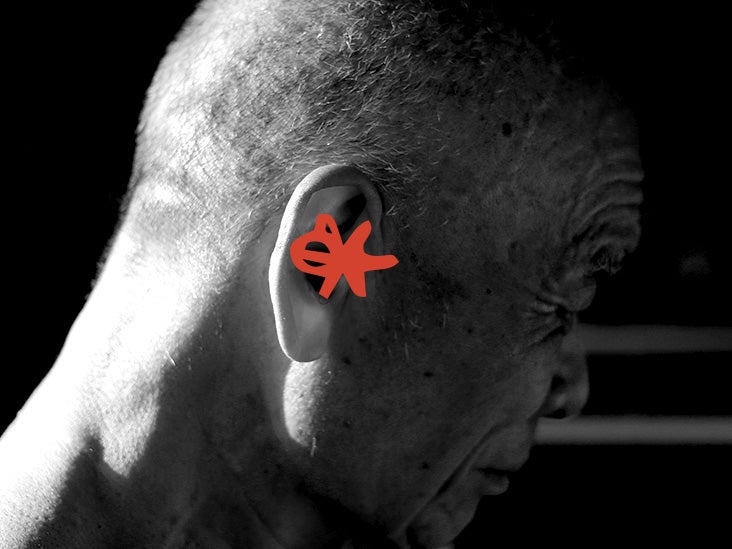 Dementia: In-ear device tracks sleep patterns to detect early signs