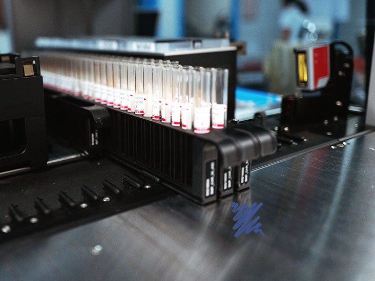 Anemia in chronic kidney disease (CKD): Symptoms, treatment