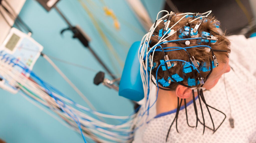 Epileptic encephalopathy: An overview