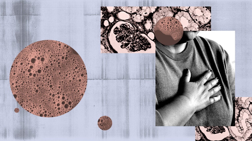 Kidney damage can increase your risk of heart disease