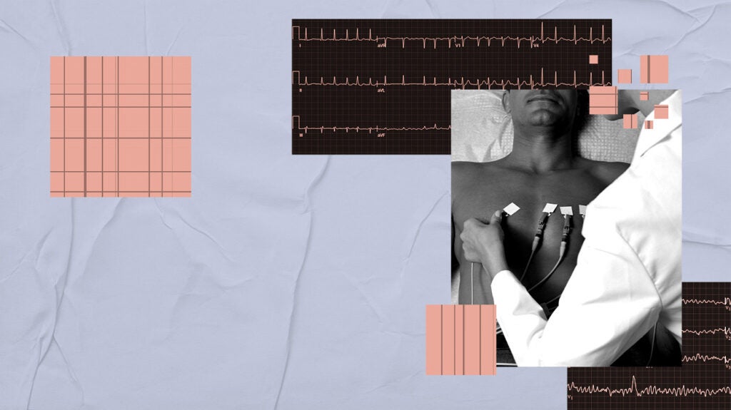 AFib vs. VFib: Similarities, differences, treatment, and more