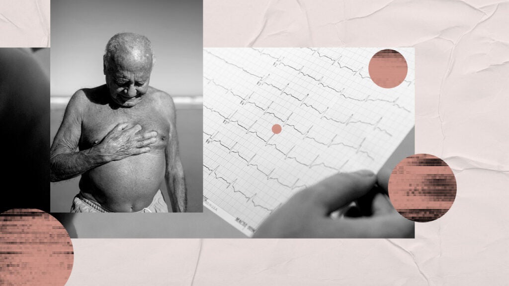 Lone atrial fibrillation: Symptoms, treatment, outlook, and more