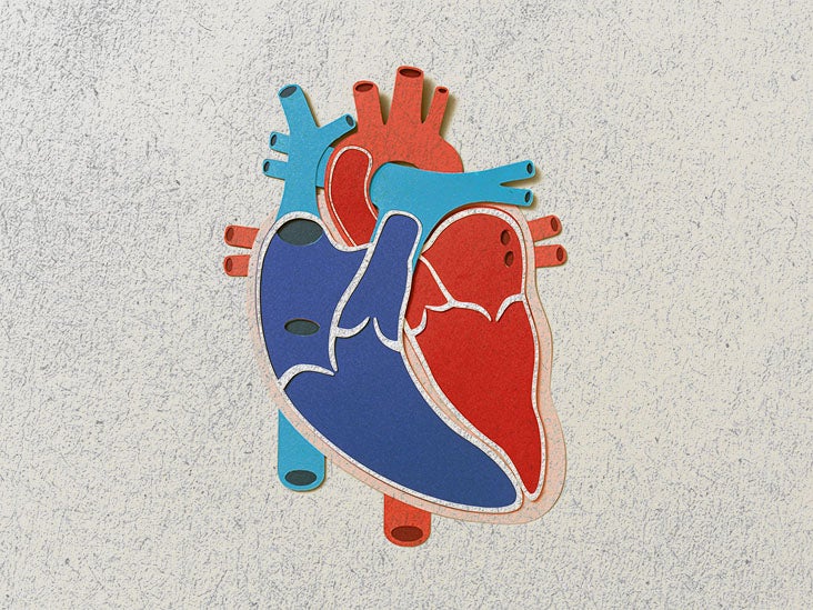 Right bundle branch block: Symptoms, treatment, and outlook