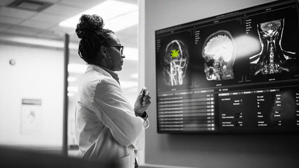 Deep brain stimulation for epilepsy: Purpose, procedure, and recovery